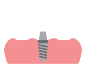 Ray Dental | Dental Clinic Klang